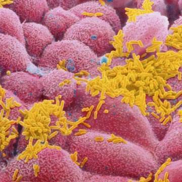 Haemophilus - EcuRed