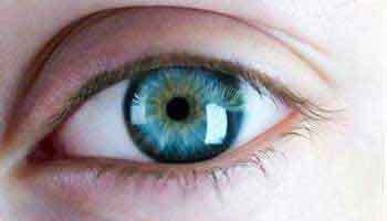 Anisometropía - EcuRed