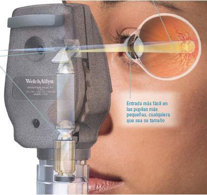 Oftalmoscopio - EcuRed