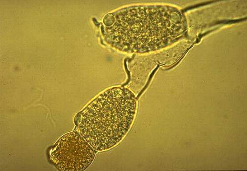 Chytridiomycota - EcuRed