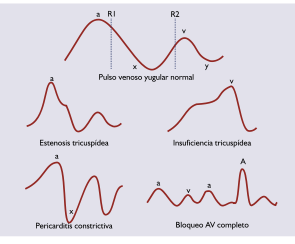 Semiología Cardíaca - EcuRed