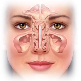 Sinusitis - EcuRed