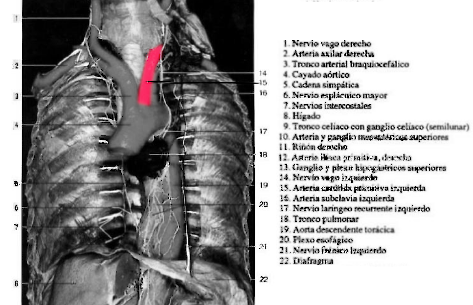 Arteria carótida común izquierda - EcuRed