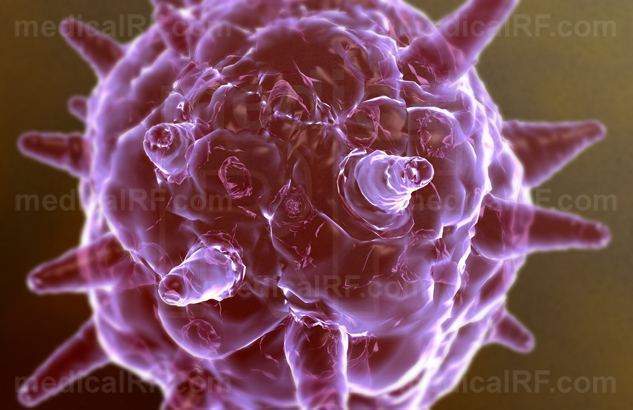 Herpes neonatal - EcuRed