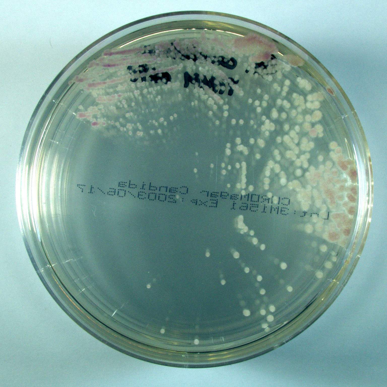 Archivo:Hongo-geotrichum-candidum.jpg - EcuRed