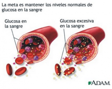 Hiperglucemia - EcuRed