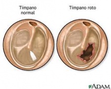 Tímpano - EcuRed