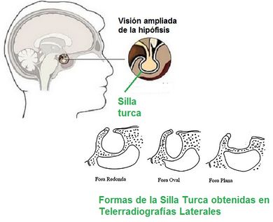 Silla turca - EcuRed