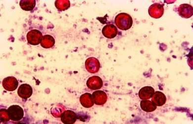 Criptosporidiosis - EcuRed