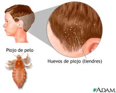 Piojo - EcuRed