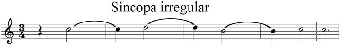 Síncopa (música) - EcuRed