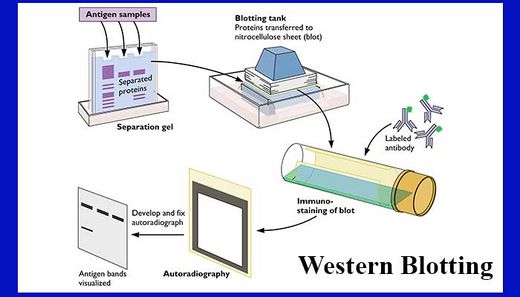 Western blot - EcuRed