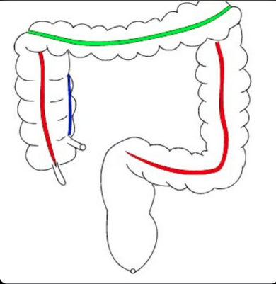 Tenias del colon - EcuRed