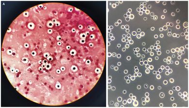 Cryptococcus neoformans - EcuRed