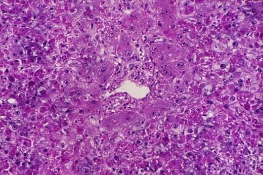 Hepatocitos - EcuRed